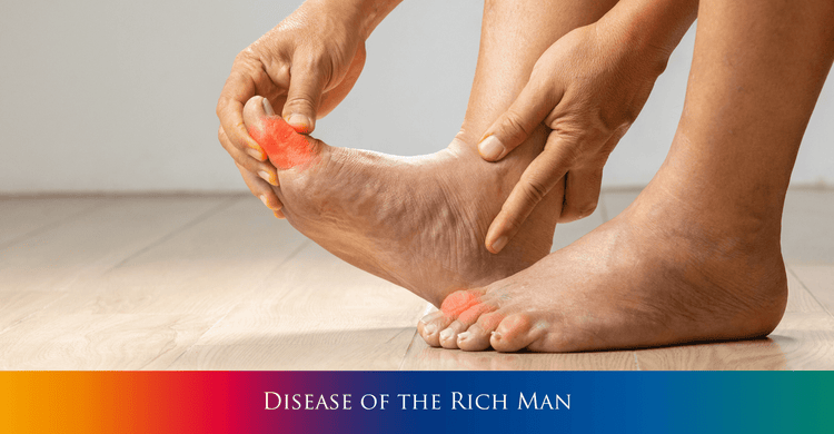 Disease of the Rich Man – Holistic Way