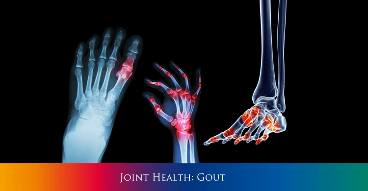 Joint Health: Gout – Holistic Way